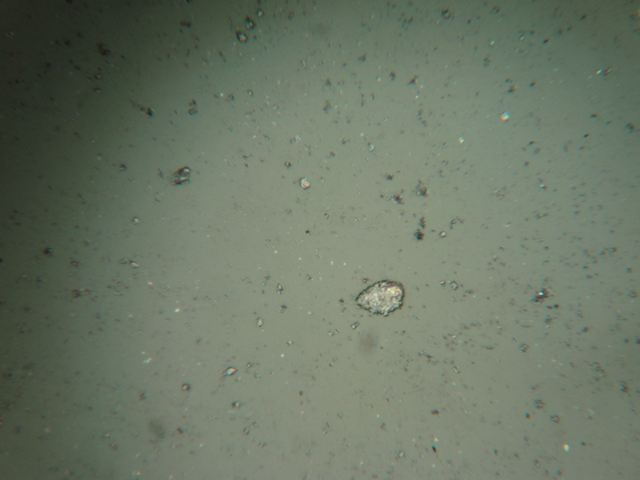 Glass Failure Expert Investigates a Tempered Glass Window Defect | Read ...